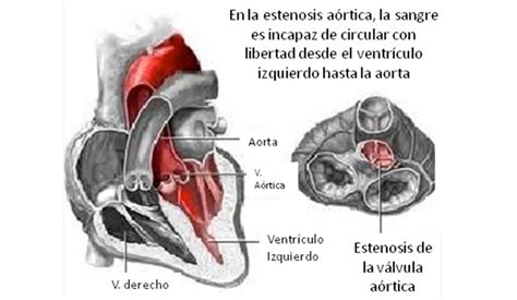 Infogen Cardiopatías Y Embarazo Enfermedades Del Corazón Y El Embarazo