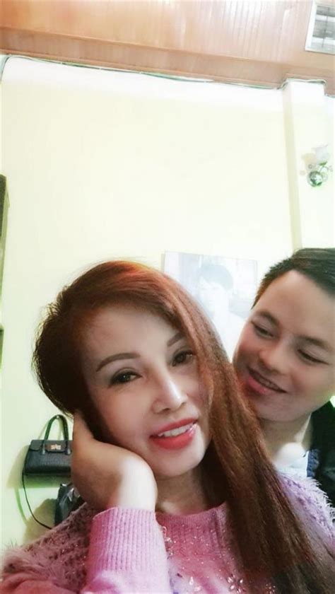 Cô Dâu 62 Tuổi Ra Sao Sau Biến Chứng Thẩm Mỹ Khiến Mặt Biến Dạng