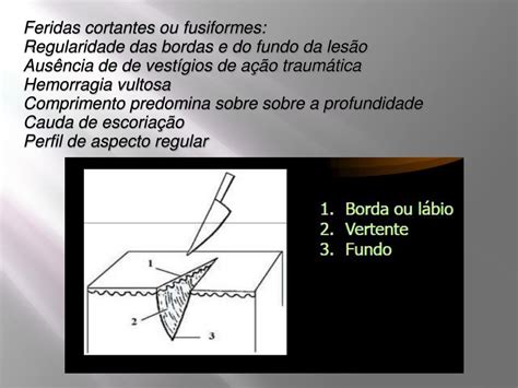 Ppt Exemplos De Morte Por Causa Não Natural Powerpoint Presentation
