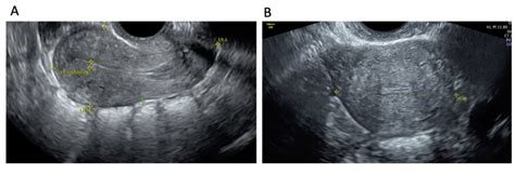 Sonography Gynecology Infertility Assessment Protocols And