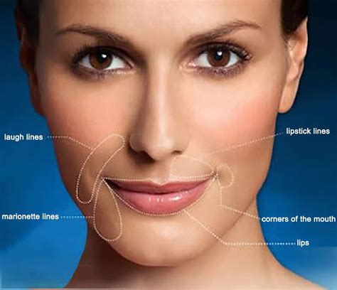Restylane Before And After Photos Contour Dermatology