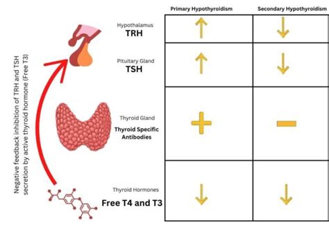Primary Vs Secondary Hypothyroidism My Endo Consult