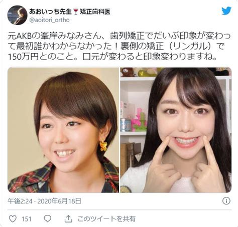 峯岸みなみは整形で目と鼻と顎と歯の4個所を弄る！顔が変わった理由はブスの呪縛だった！ 芸能人の裏ニュース