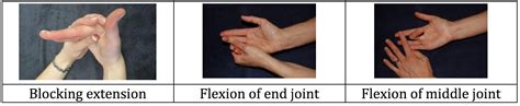 Examples Of Finger Exercises Hand Therapy Group
