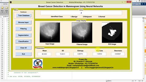breast cancer detection and classification in mammogram