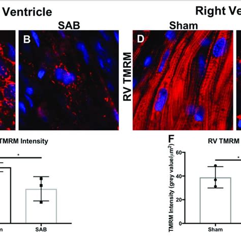 Mitochondrial Pyruvate Carrier 1 Mpc1 Is Upregulated In