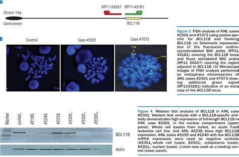 Figure 3 From Integrated Genome Wide Genotyping And Gene Expression