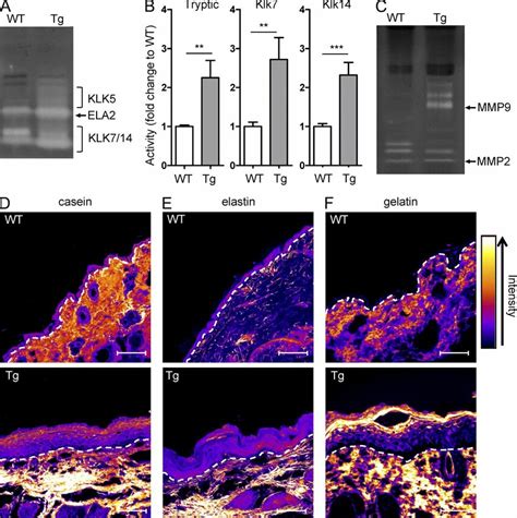Klk5 Overexpression Dysregulates An Epidermal Protease Activation