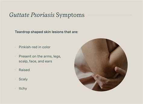 What Is Guttate Psoriasis Causes Symptoms And Treatments