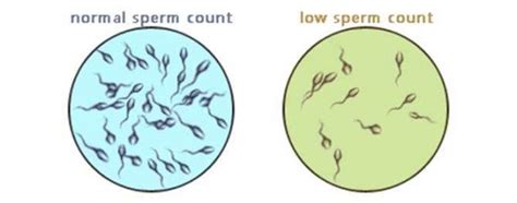 Low Sperm Count Heres What You Can Do Esha Ivf