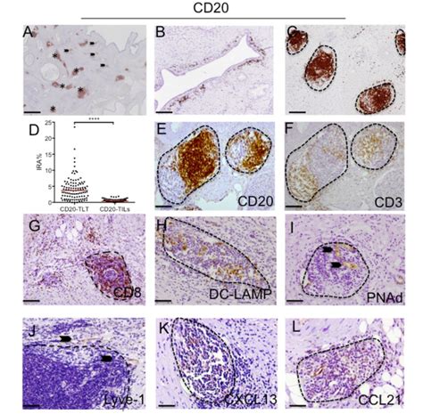 B Cells Strategically Localize In Tertiary Lymphoid Tissue In Human