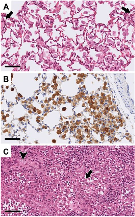 Histopathological Examination A Hematoxylin And Eosin Hande Stain Of