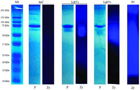 Protein Constitution And Proteolytic Activity Of Evs From L Shawi And