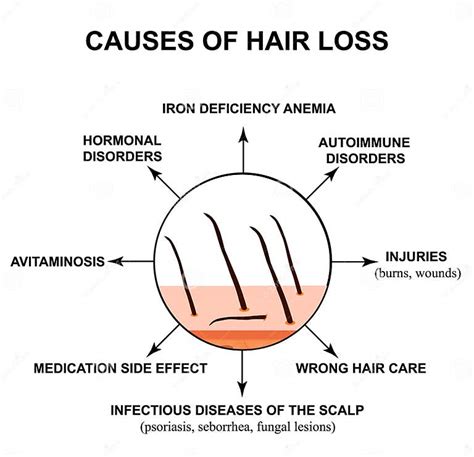 Causes Of Hair Loss The Structure Of The Skin And Hair Infographics