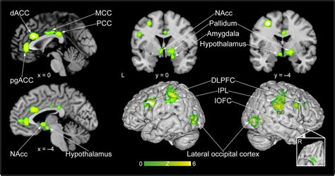 Arousal In Brain