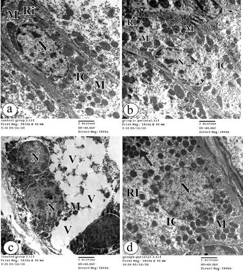 The Electron Photomicrographs Of The Parietal Cell In A The Group Ӏ