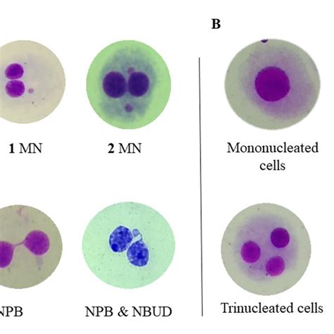 A A Micrograph Of Binucleated Cells Without And With Different Number