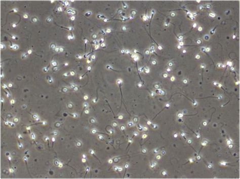 Semen Collection Steps Video Medical Sperm – Telegraph