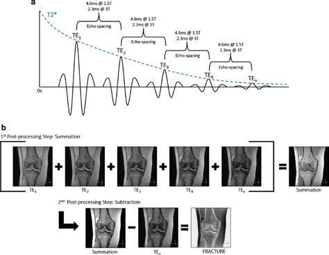 Comparison Of Fracture Sequence Ai To Matching Ct Multiplanar