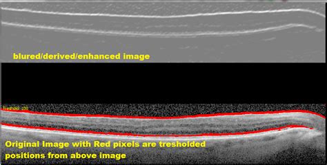 python how to extract the borders of an image oct
