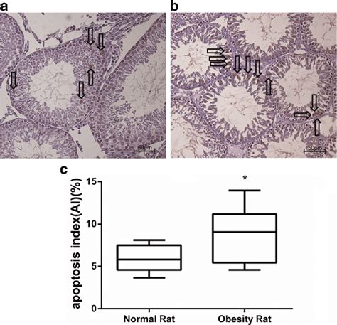 Apoptosis Of Spermatogenic Cells In Testicular Tissues And Comparison