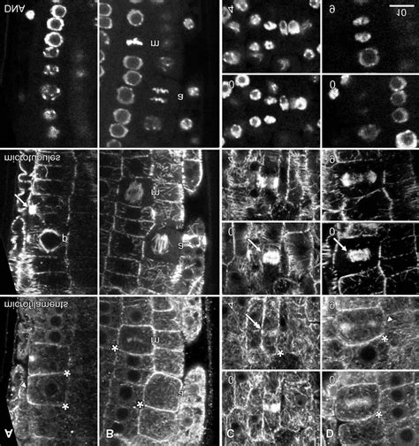 Microfilaments And Microtubules In A Plant Cell