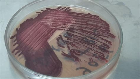 Cedecea Davisae Introduction Morphology Pathogenicity Lab Diagnosis
