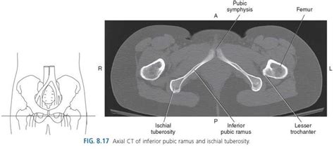 Pelvis Sectional Anatomy For Imaging Professionals 4th Edition