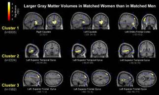 Why Sex Matters Brain Size Independent Differences In Gray Matter