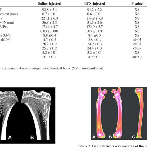 Bone Mineral Density Assessed By Microct And Correlation With