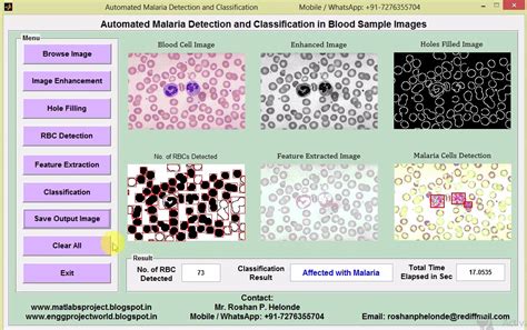 malaria parasite detection using image processing matlab