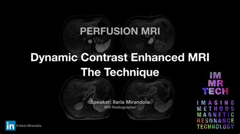 Dynamic Contrast Enhanced Mri The Technique Youtube