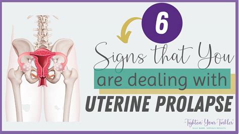 6 Signs Of Uterine Prolapse