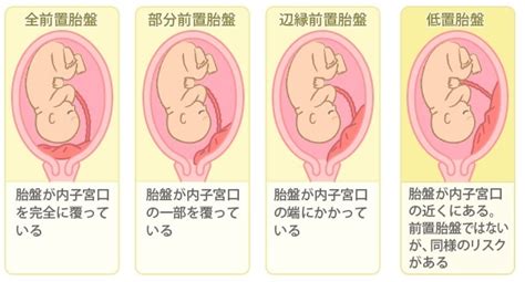 コンプリート！ 妊娠 子宮の位置 177289 妊娠 子宮の位置 変化