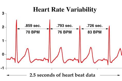 Whats Your Heart Rate Variability It May Be Time To Find Out Wsj