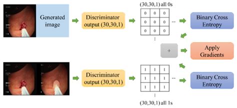 Diagnostics Free Full Text A Novel Computer Aided Detection