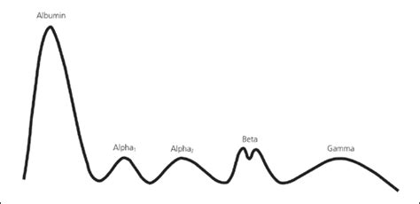 Understanding And Interpreting Serum Protein Electrophoresis Aafp