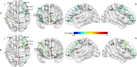 Differential Pcc Based Voxel Wise Functional Connectivity For Fes And