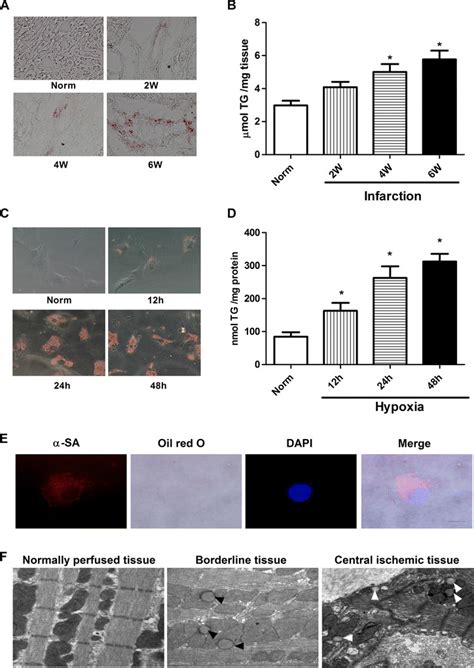 Accumulation Of Neutral Lipids In Heart Of Infarcted Rat And Hypoxia