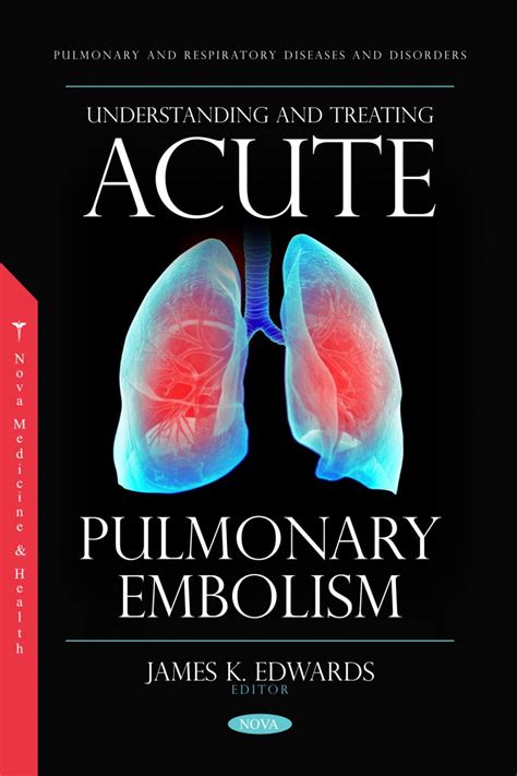 Understanding And Treating Acute Pulmonary Embolism – Nova Science