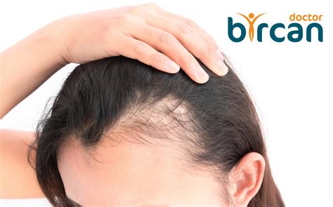 Women Hair Transplant In Turkey • Female Hair Transplant