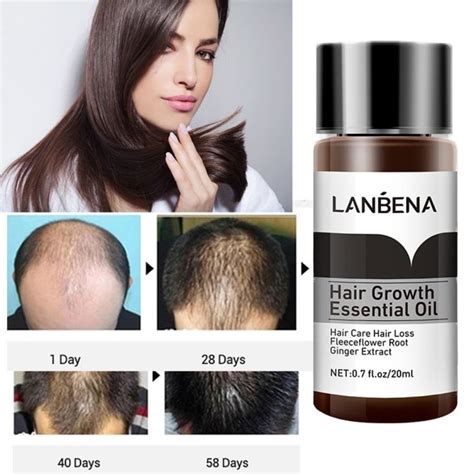 Hair Grower For Men Original Lanbena Hair Growth Essence Spray Product