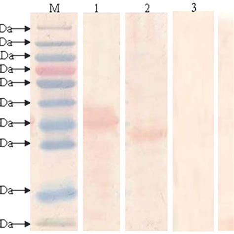 Western Blot Analysis Of Recombinant Hypothetical Secreted Protein Of