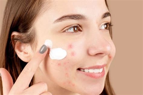 5 Rekomendasi Masker Wajah Untuk Kulit Berjerawat Lifestyle Katadata