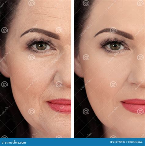 Collage Avec Des Photos De Femme Mature Avant Et Après La