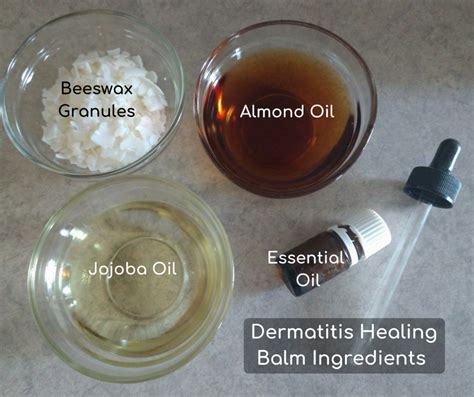 How I Got Rid Of Itchy Contact Dermatitis The Natural Way Remedygrove