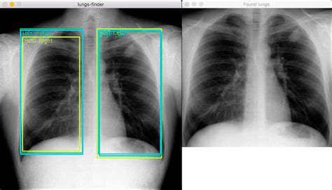x ray image segmentation python mageusi