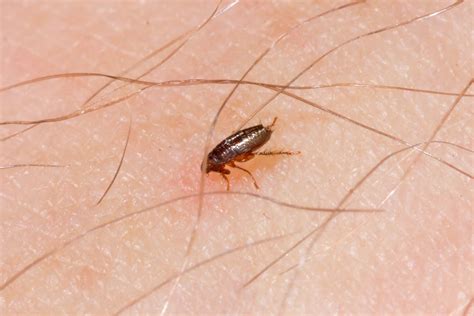 How Do Humans Get Rid Of Fleas In Their Hair Benita Cardona