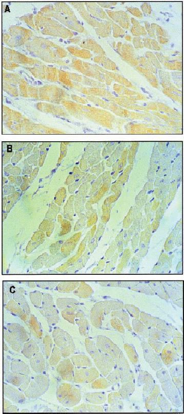 A Representative Western Blots For Tnf ␣ Il 6 Igf 1 Download