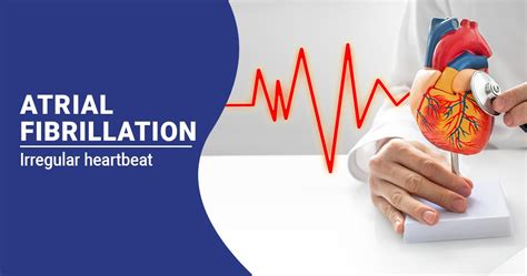 Atrial Fibrillation Afib Causes And Treatment